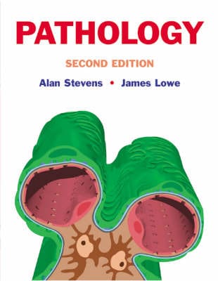 Alan Stevens: Pathology [2000] paperback – Chapters Bookstore